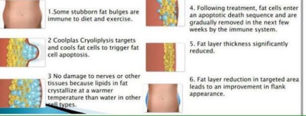 Cool Body Sculpting (Fat Freezing) - Christchurch IPL & Cool Body ...
